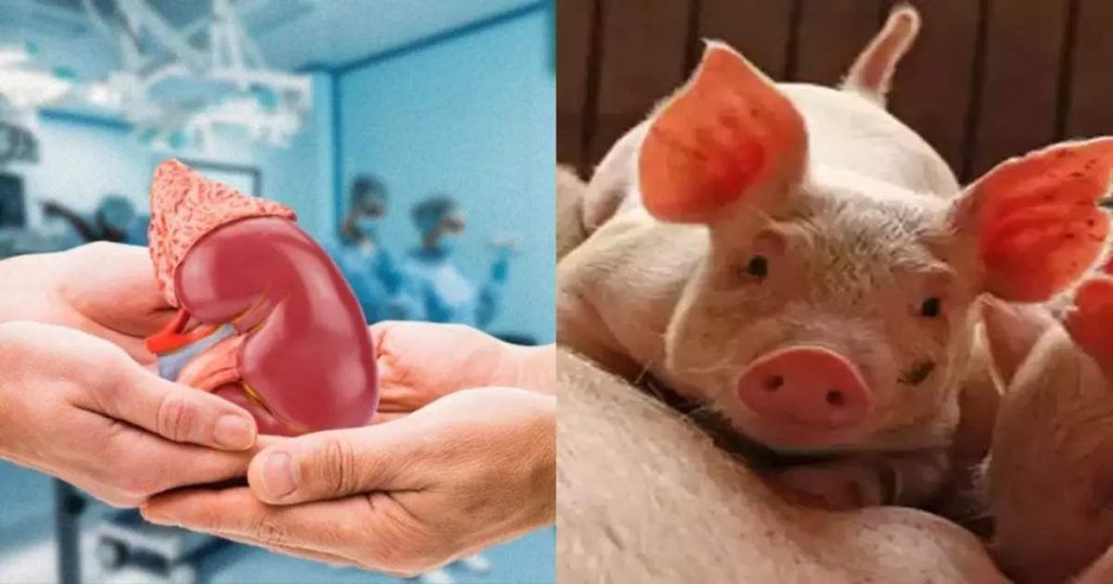 Pig Kidney Transplant Still Keeping Man Alive After a Month - GhScientific